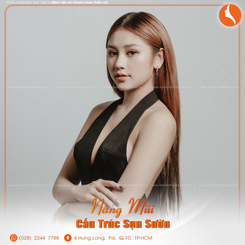 Sống mũi Silicone và Sống mũi Surgiform | Ts. Bs Nguyễn Thành Nhân